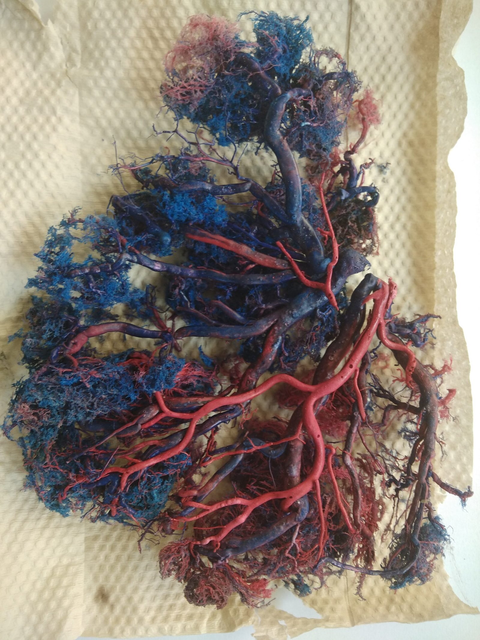placentalpathologist.com – "Transforming Placental Science for Better ...